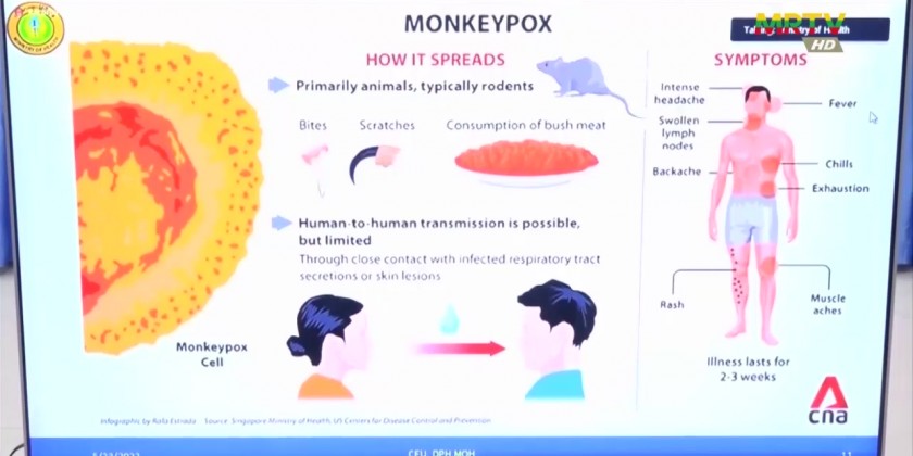 Monkeypox Prevention: Ministry of Health making preparations | Myanmar ...