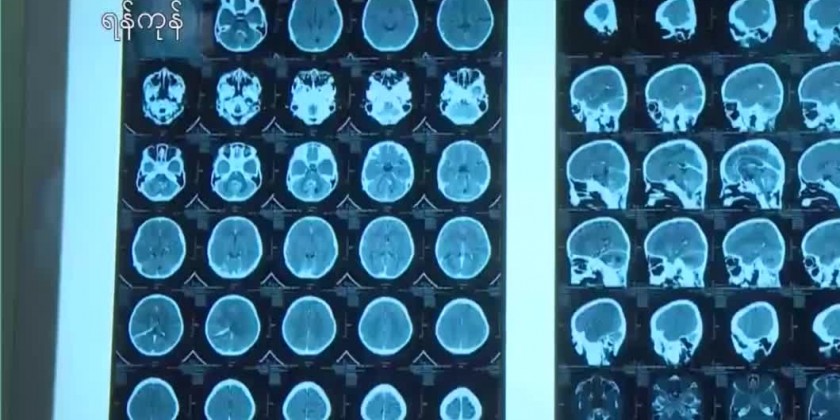 Neurosurgery for Children: Japanese neurosurgeonperforms 2nd timebrain ...